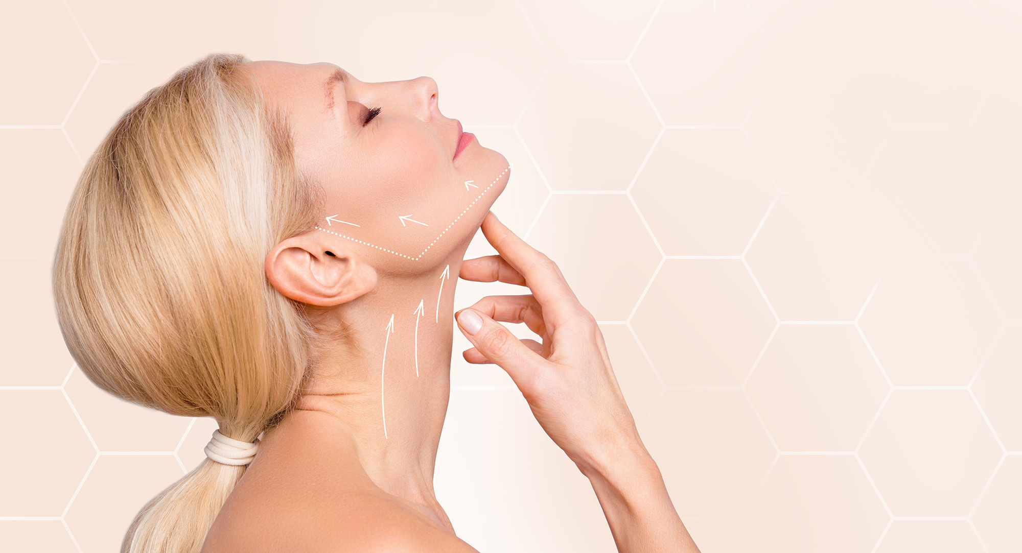 Deep Plane Facelift Recovery | British Face Clinic